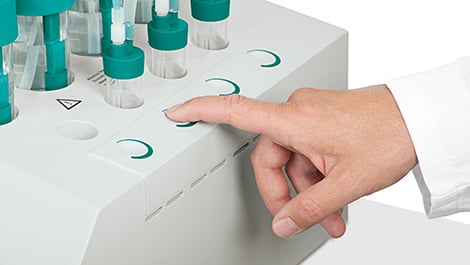 Oxidative Stability Index (OSI)